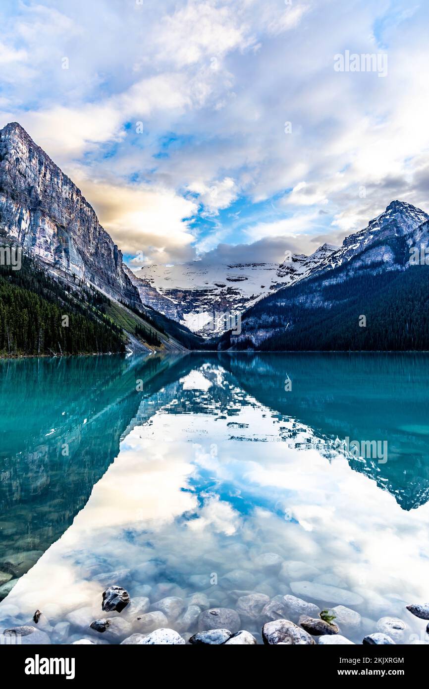 A vertical shot of Lake Louis in Banff National Park, Canada in Alberta ...