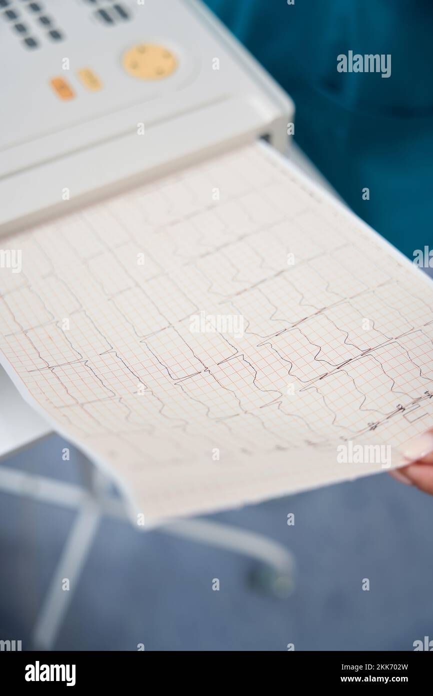 Ischemic system hi-res stock photography and images - Alamy