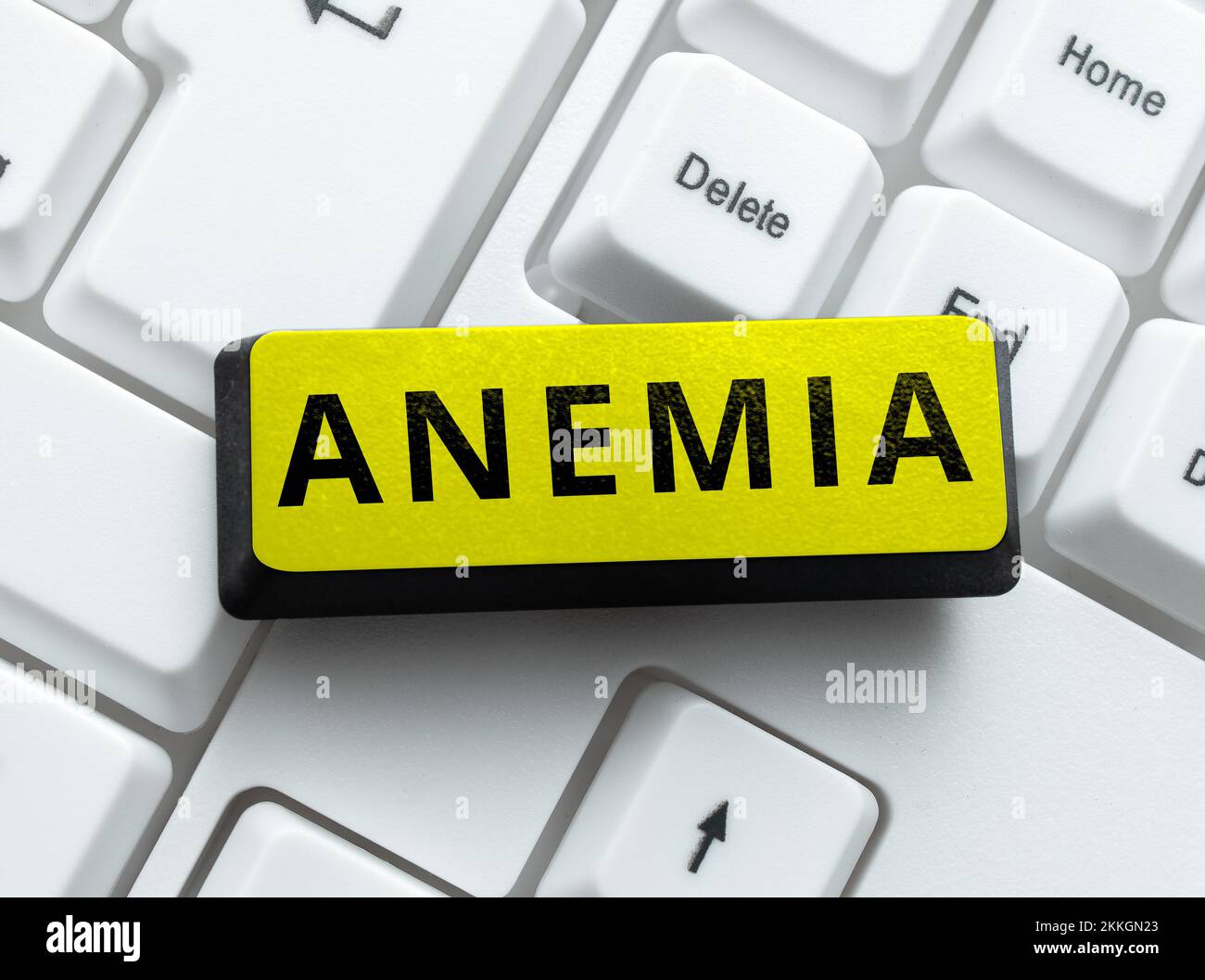 Text sign showing Anemia, Conceptual photo condition where there ...