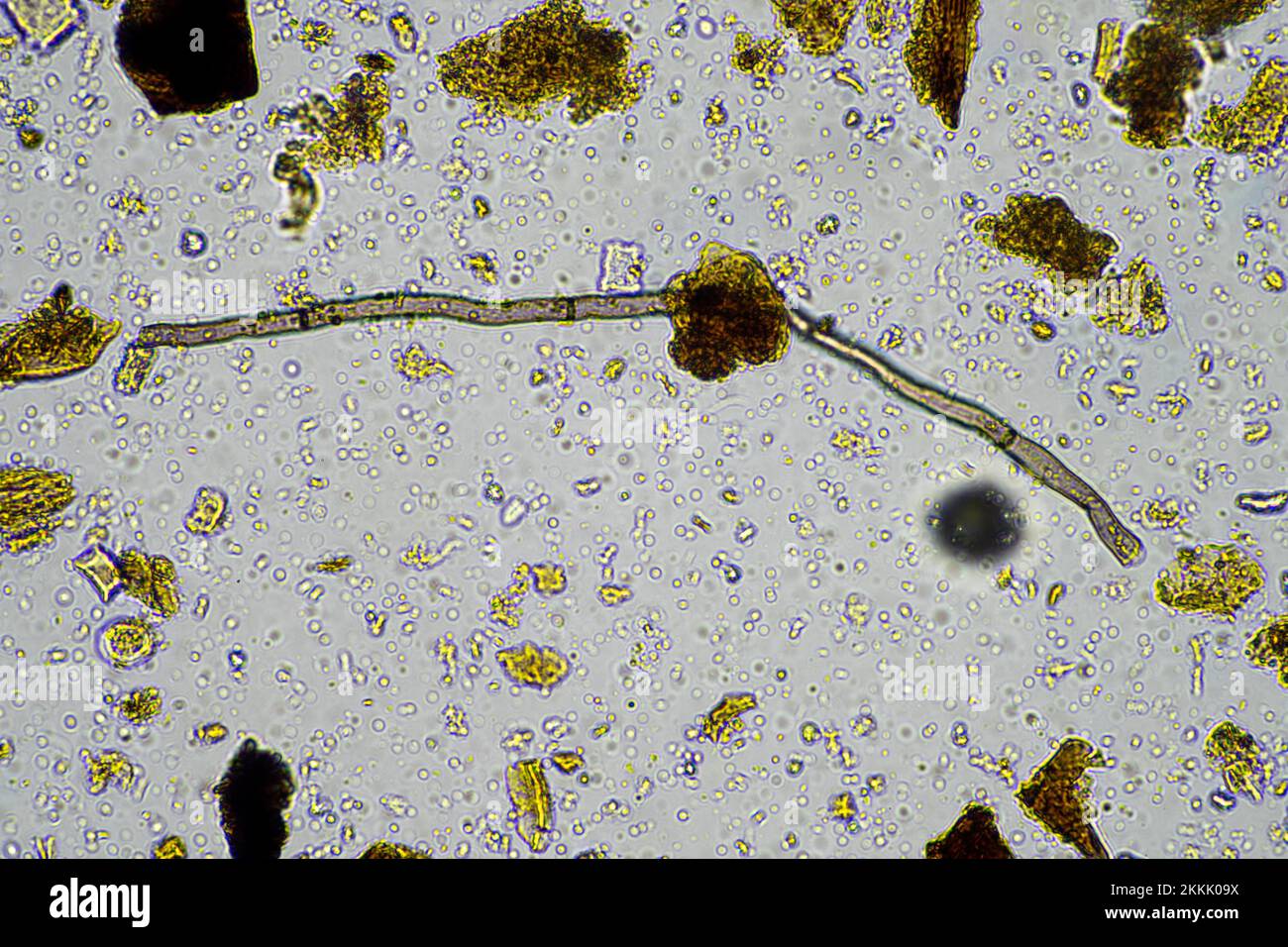 soil fungi and microorganisms in a soil and compost sample in spring ...