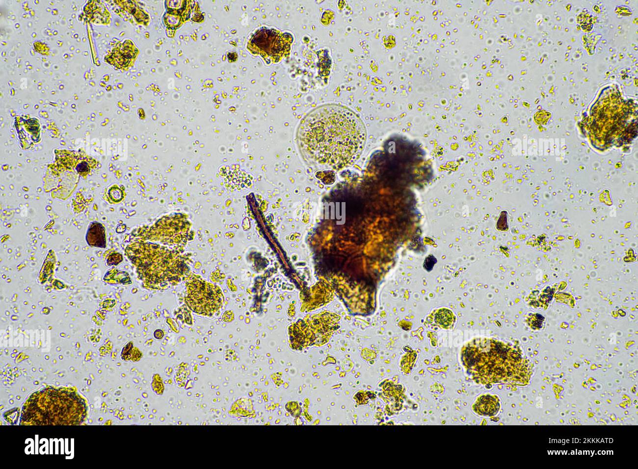 soil microorganisms on a regenerative farm, storing carbon in fungi and ...