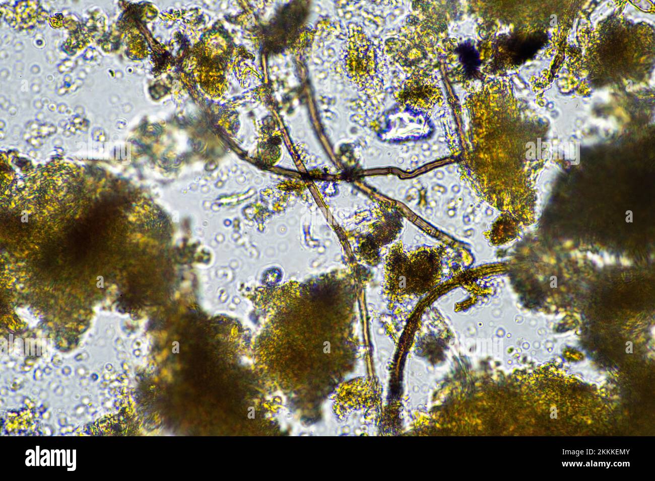 soil fungi and microorganisms in a soil and compost sample in spring ...