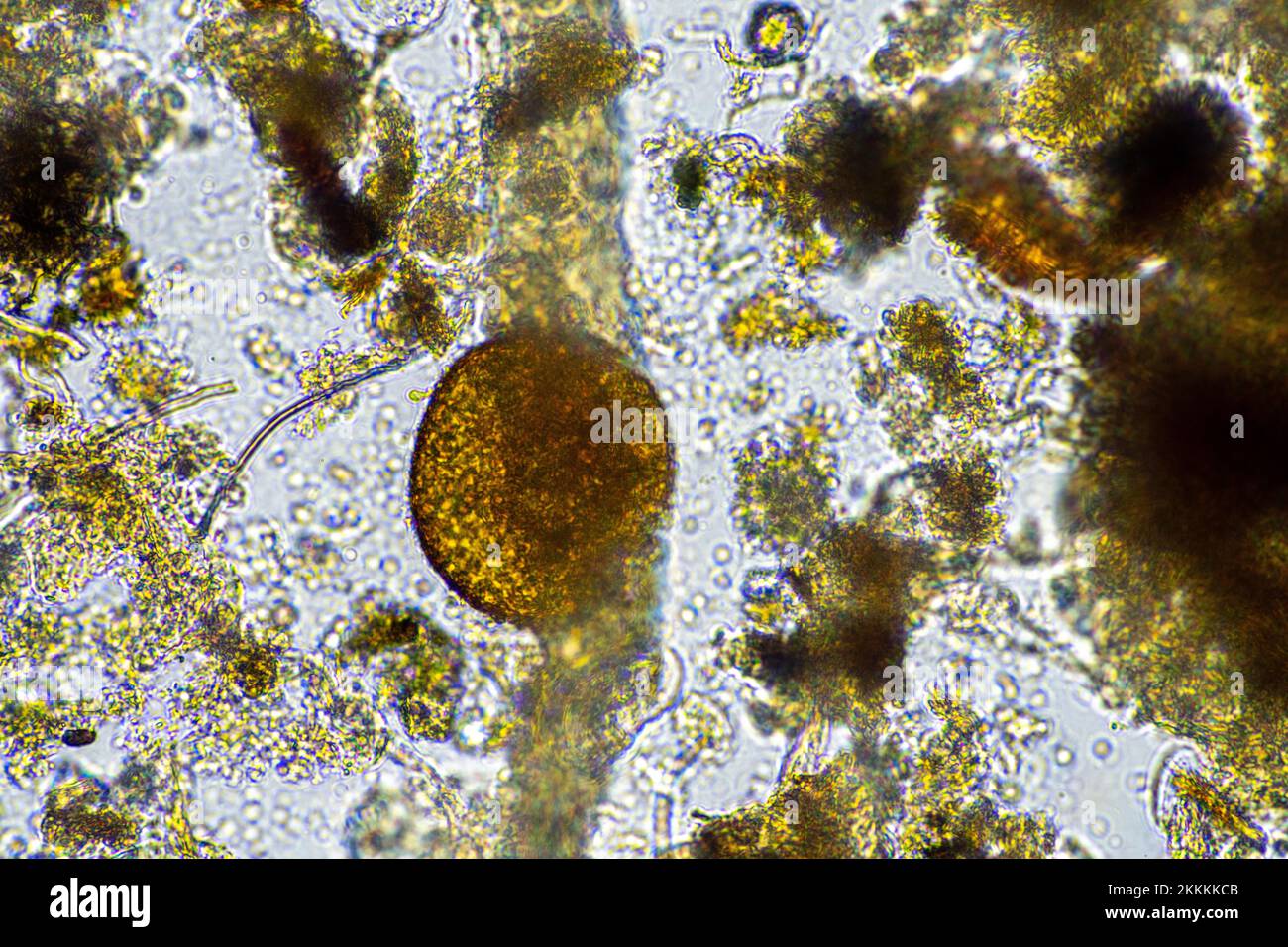 soil fungi and microorganisms in a soil and compost sample in spring ...