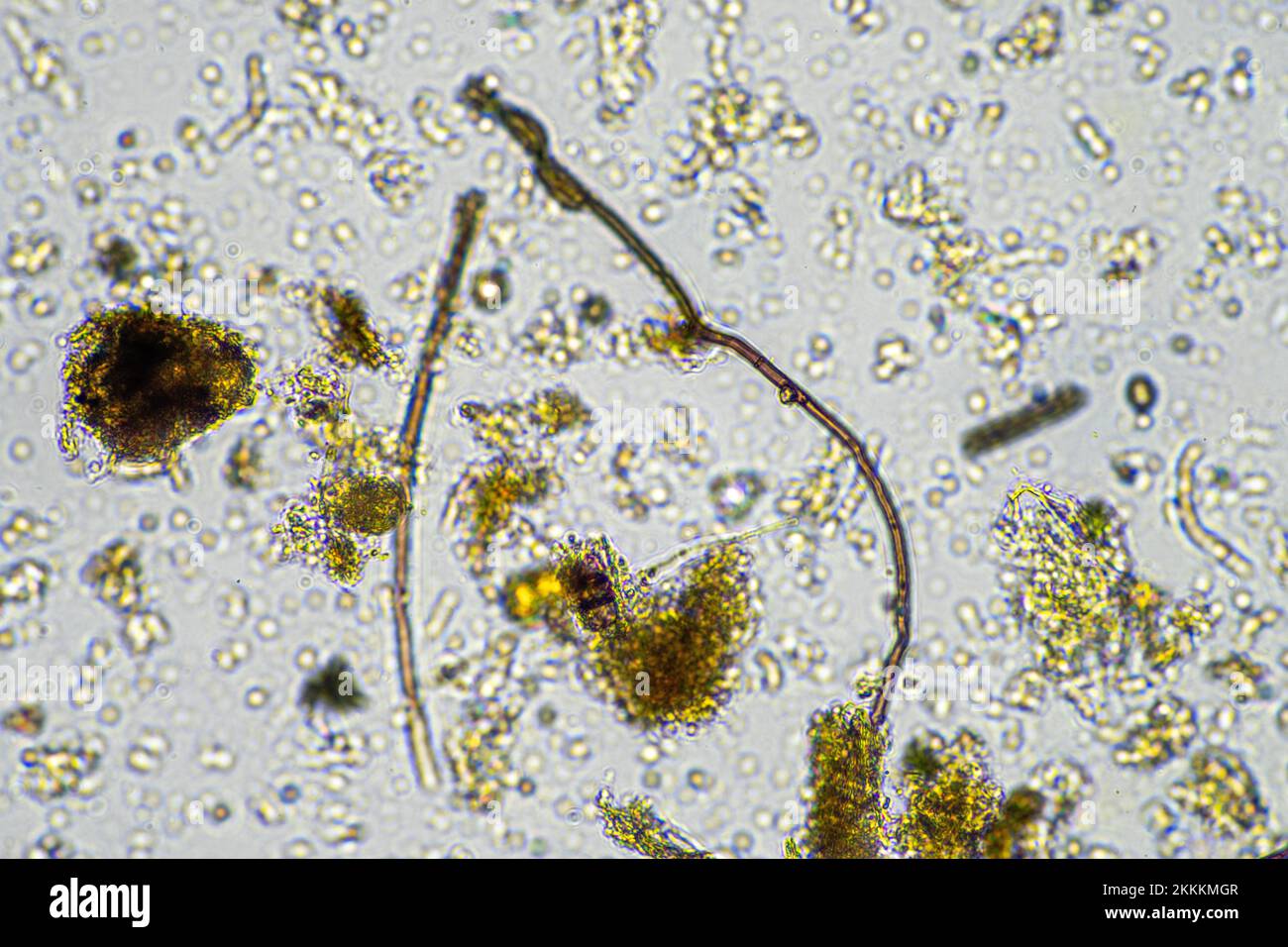 soil fungi and microorganisms in a soil and compost sample in spring ...