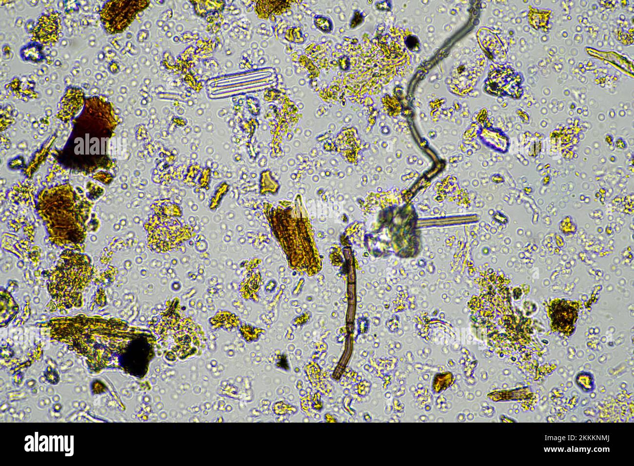 soil fungi and microorganisms in a soil and compost sample in spring ...
