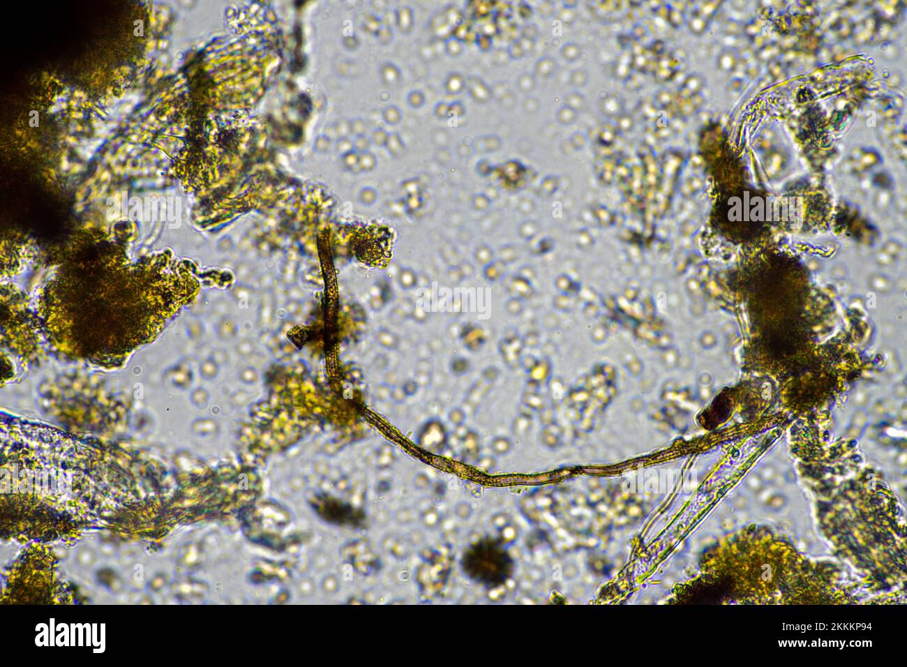 soil fungi and microorganisms in a soil and compost sample in spring ...