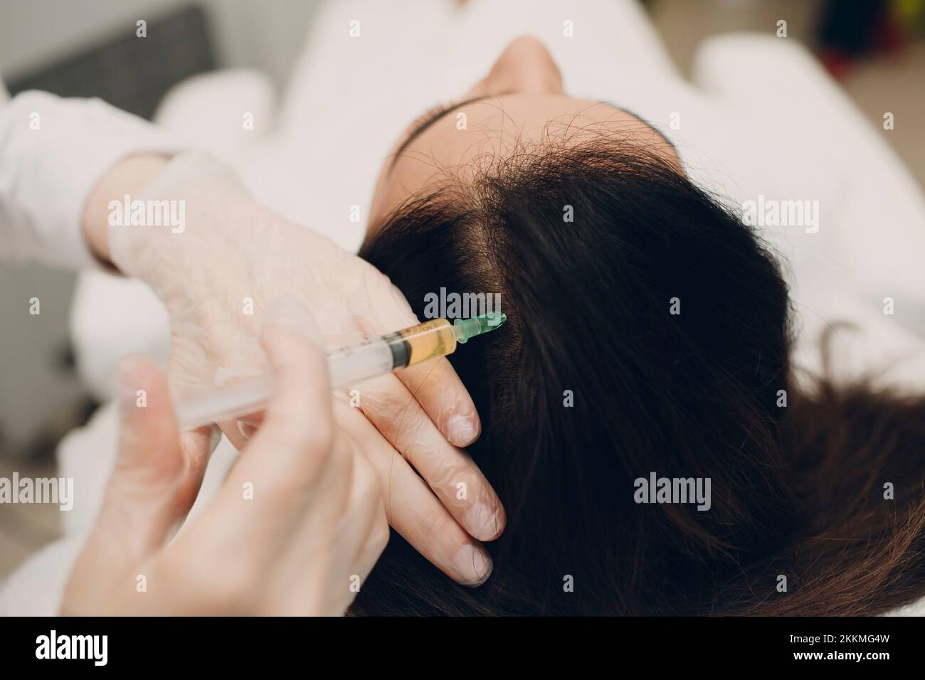 Cosmetic scalp injection Stock Photo - Alamy