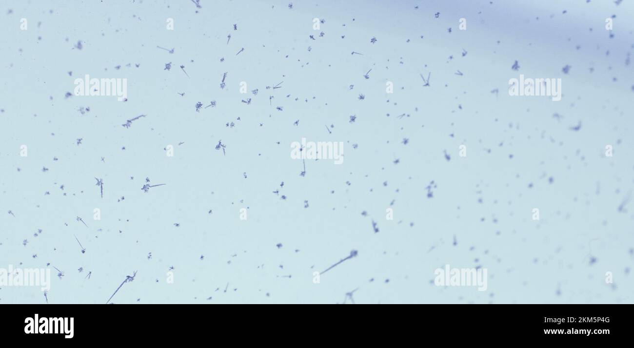 Small ice crystals form on the airplane window Stock Photo - Alamy