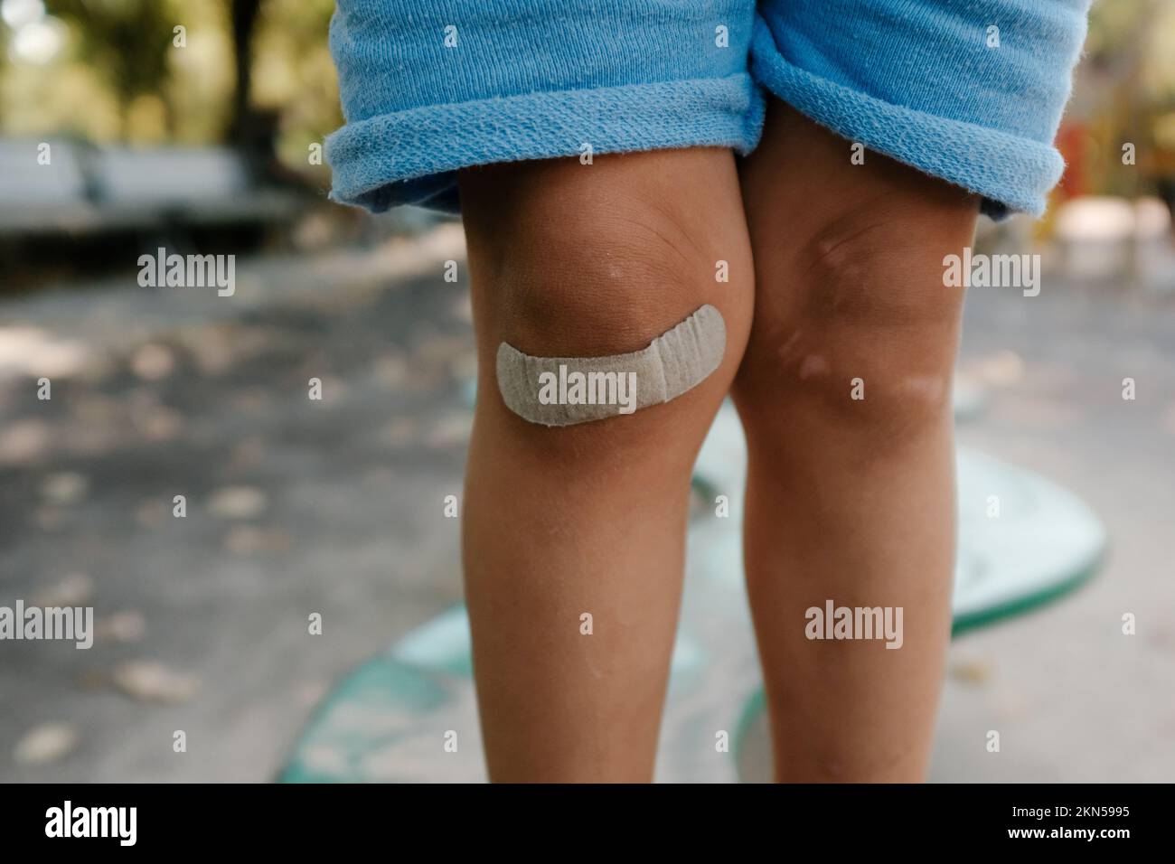A closeup of a 2 years old boy's legs with a plaster on knee standing ...