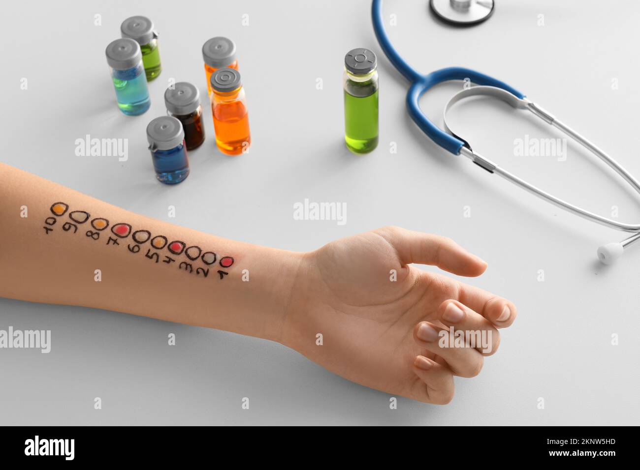 Marked female hand for allergen skin tests, ampules and stethoscope on ...