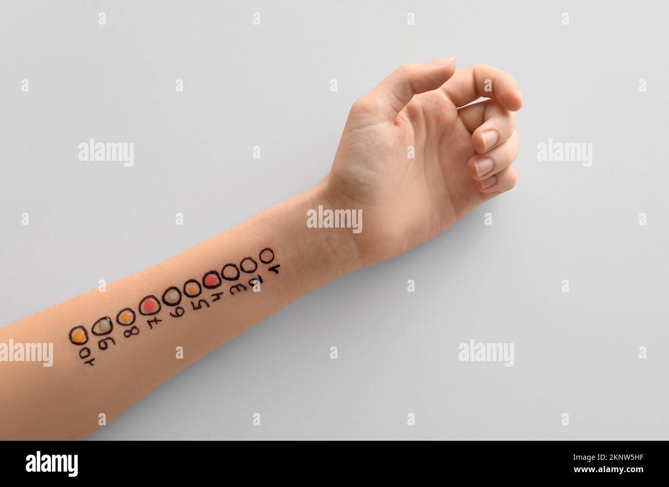 Woman with marked hand for allergen skin tests on white background ...