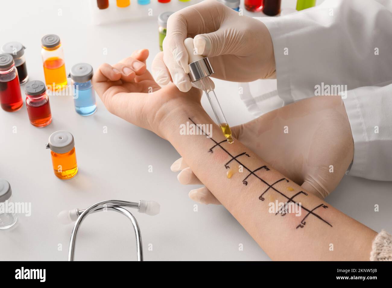 Doctor making allergy skin test on patient's hand in clinic, closeup ...