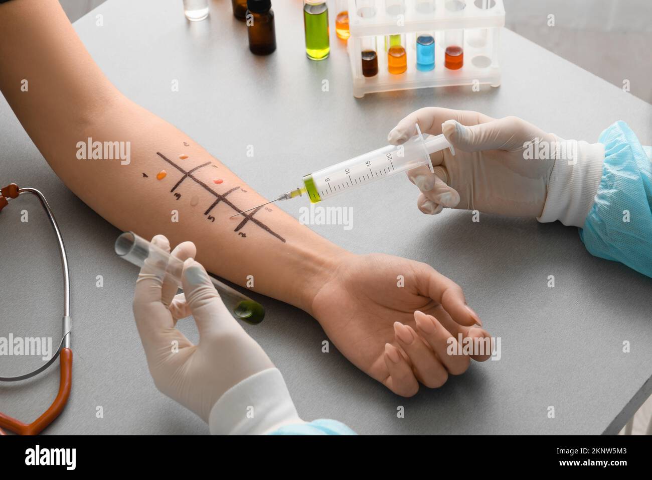 Doctor with syringe making allergy skin test on patient's hand in ...