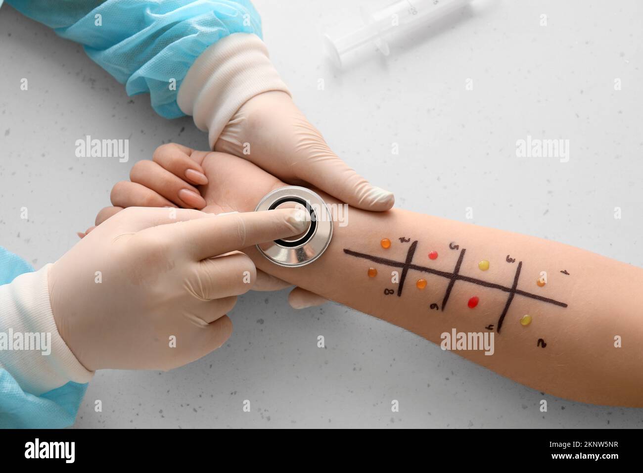 Doctor with stethoscope making allergy skin test on patient's hand in ...