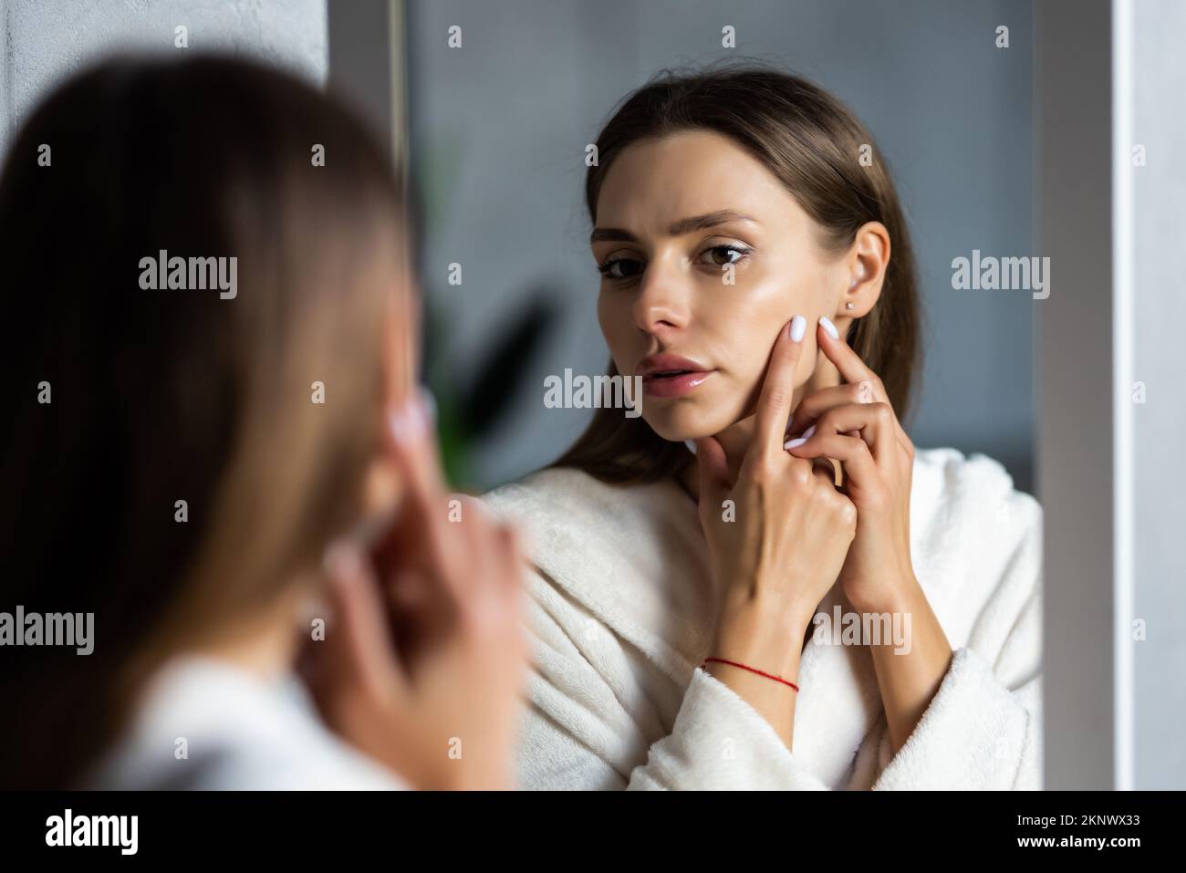 Portrait of teenage girl having problems with skin Stock Photo - Alamy
