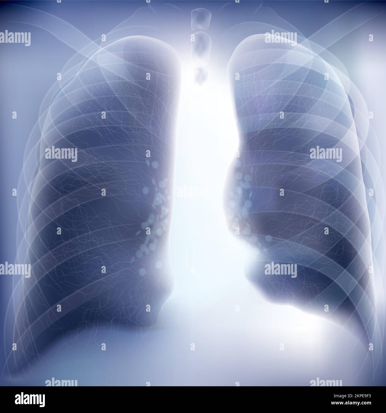 Chest diagnosis Stock Vector Images - Alamy