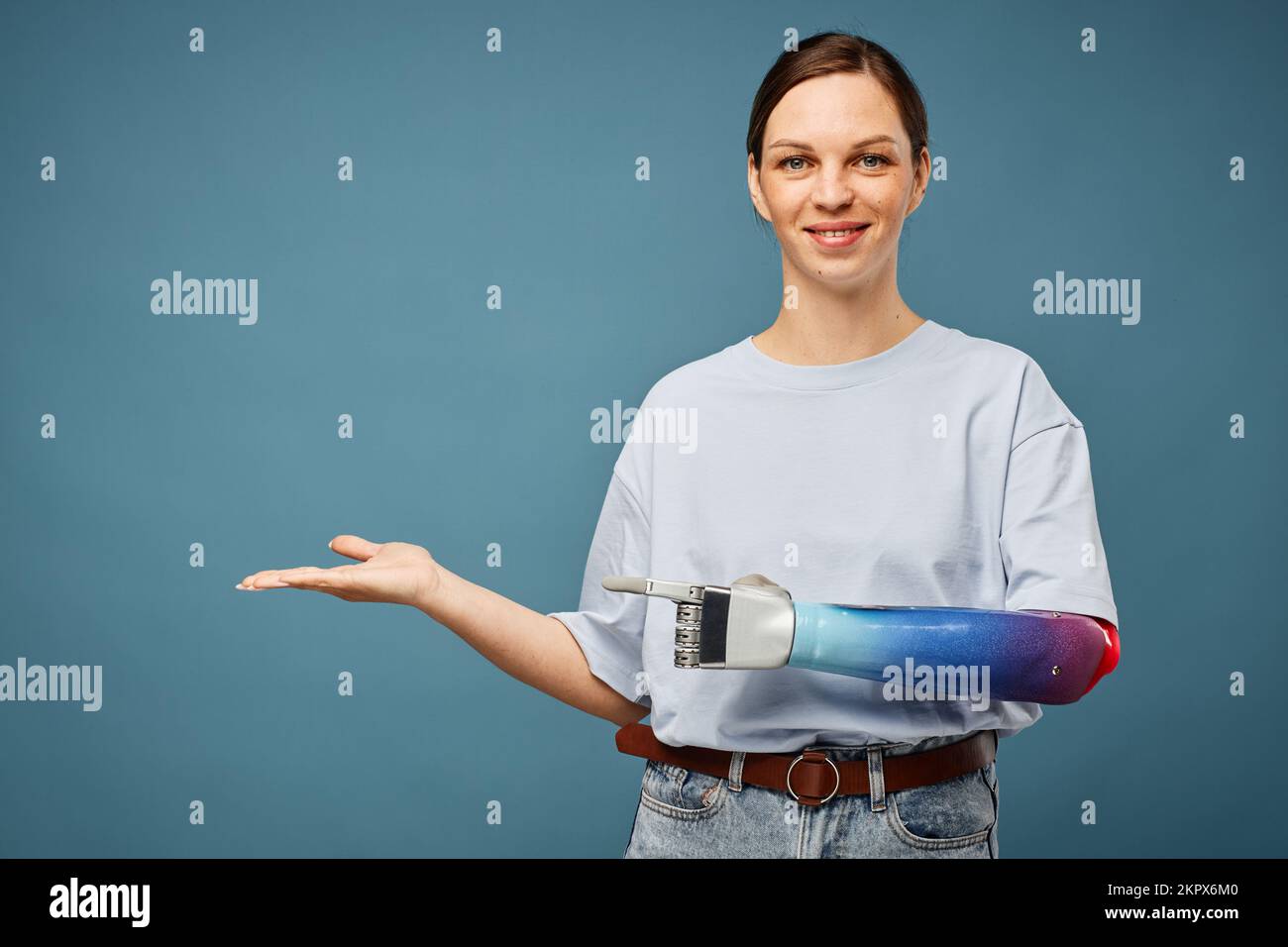 Cheerful young woman with bionic arm showing new project Stock Photo ...