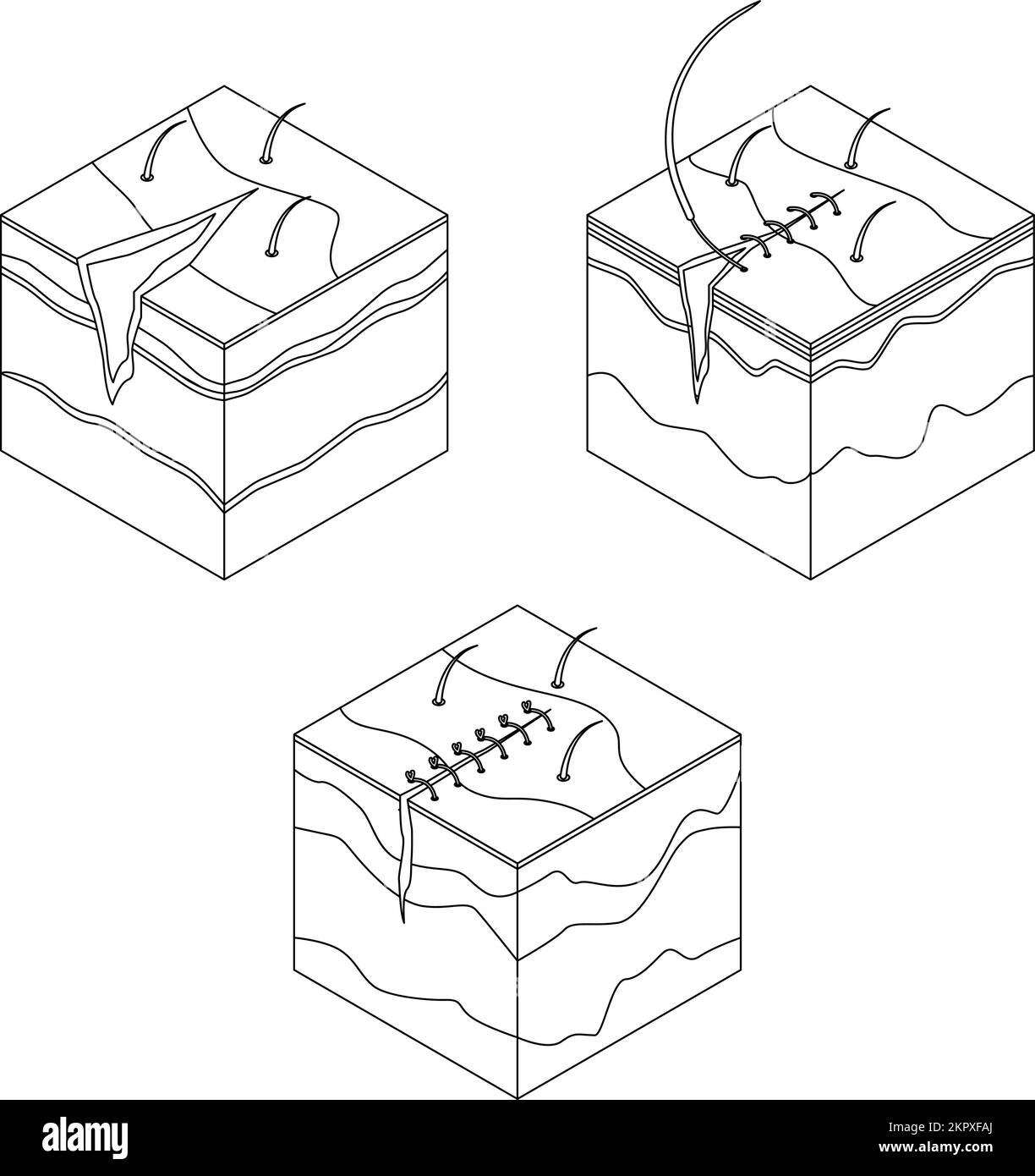 Surgical suture icons set. Isometric set of surgical suture vector icons outline vector on white ...