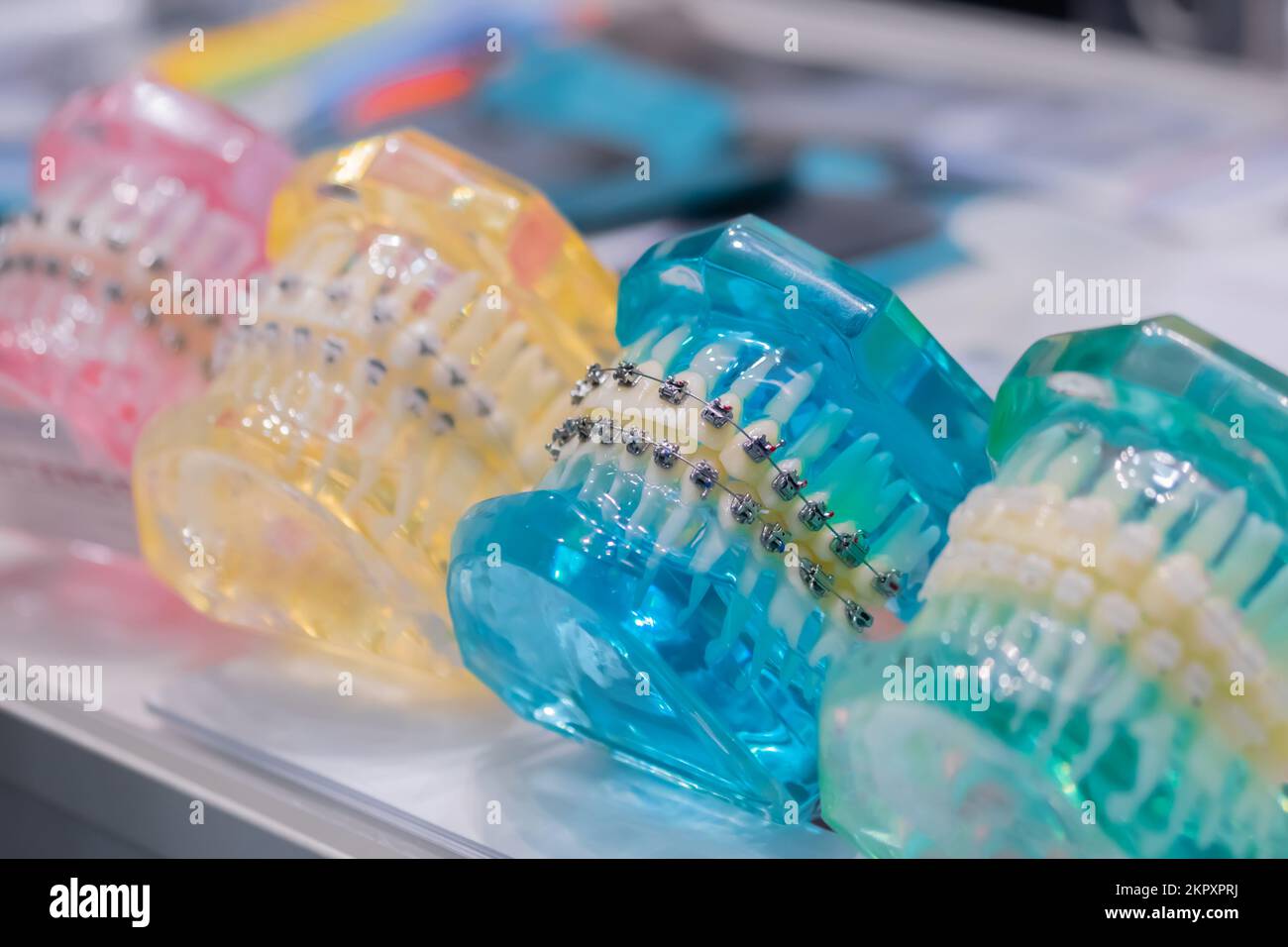 Transparent human jaws with orthodontic bracket, metal and ceramic ...