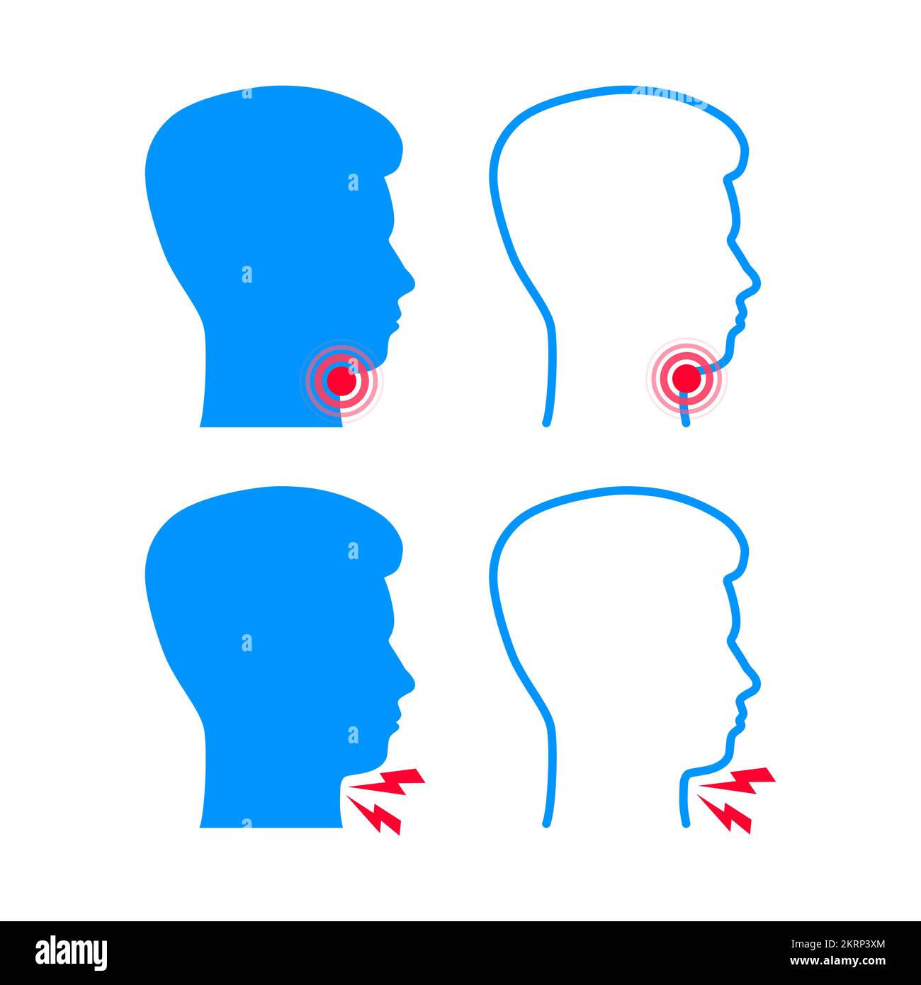 Sore Throat. Symptoms Icon. Bacterial and viral infection, Laryngitis ...