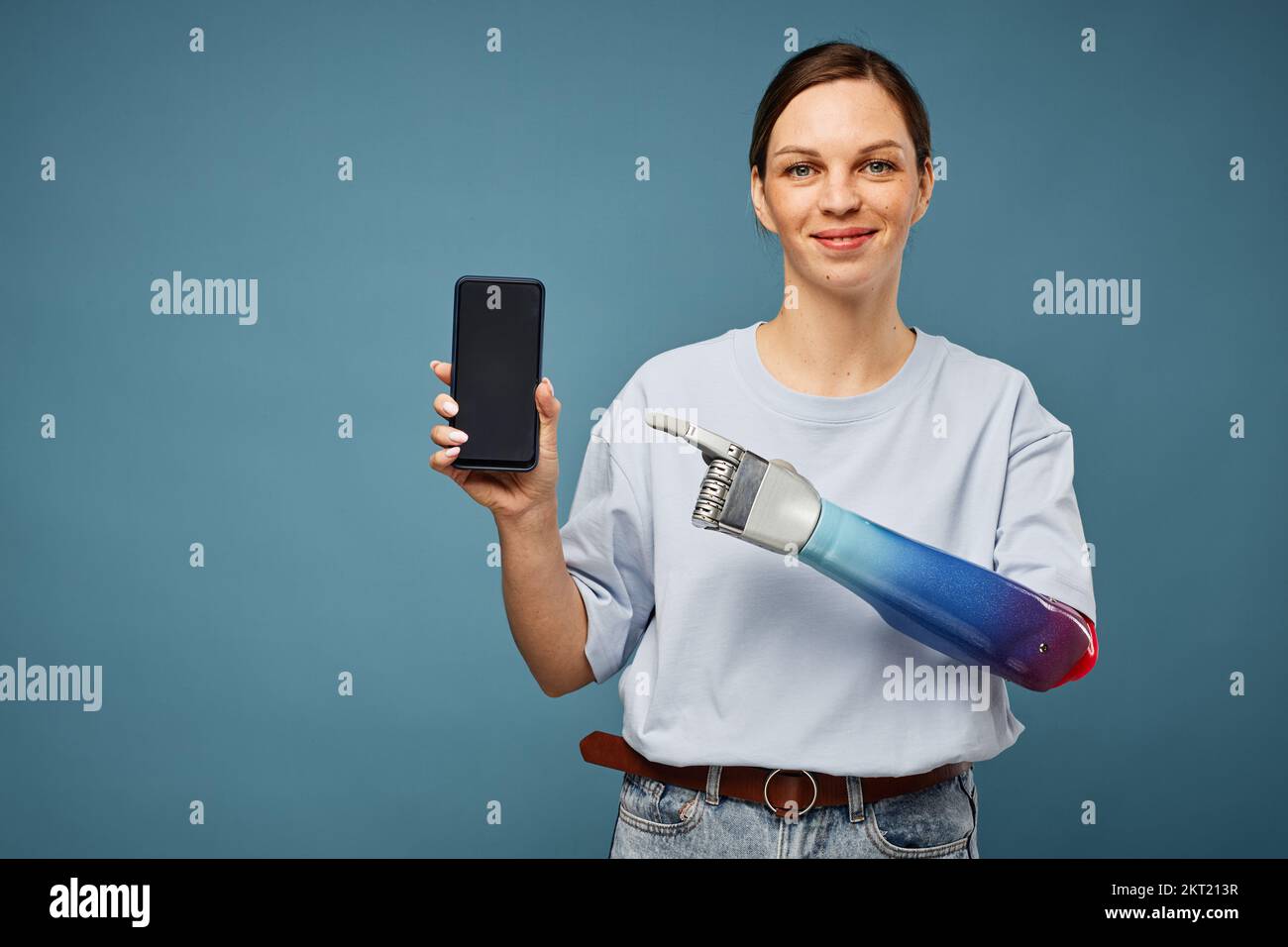 Happy young woman with prosthetic arm pointing at smartphone screen ...