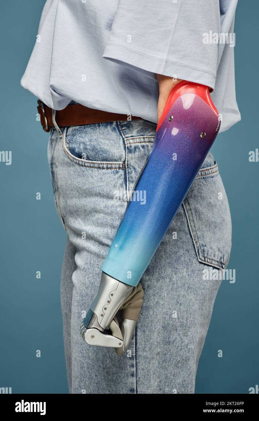 Side view of person with bionic arm clenching fist Stock Photo - Alamy