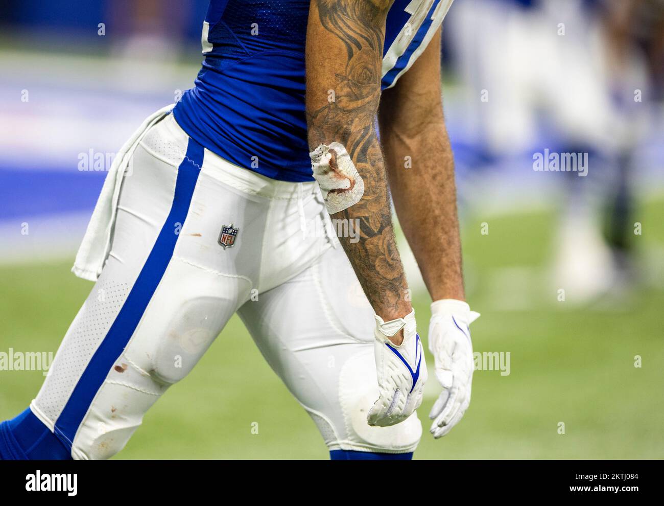 Bloody elbow hi-res stock photography and images - Alamy