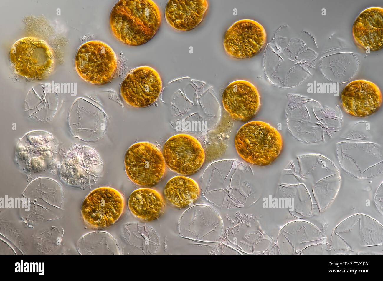 Peridinium centenniale algae, light micrograph Stock Photo - Alamy