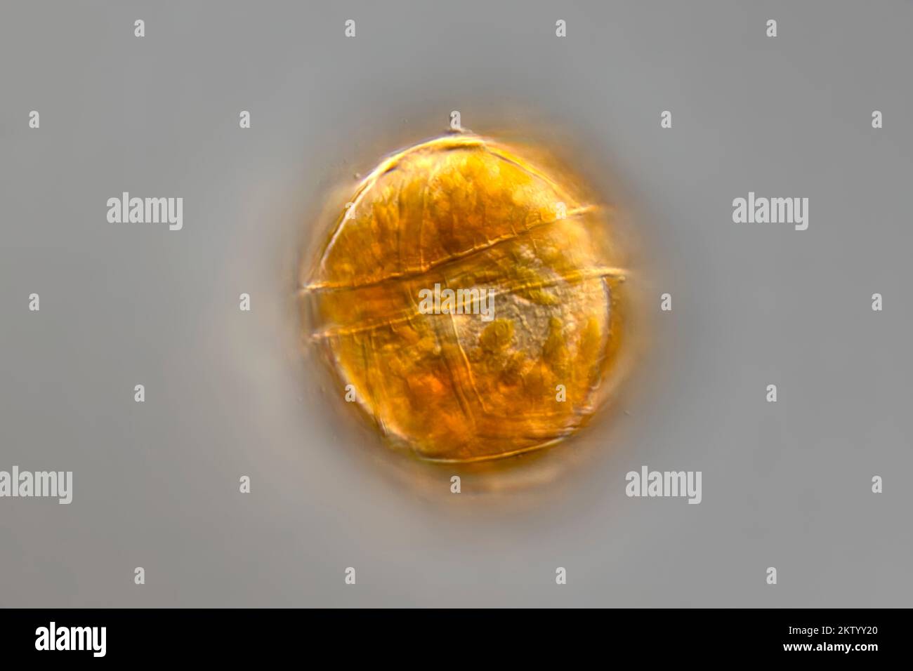 Peridinium cinctum, algae, light micrograph Stock Photo - Alamy