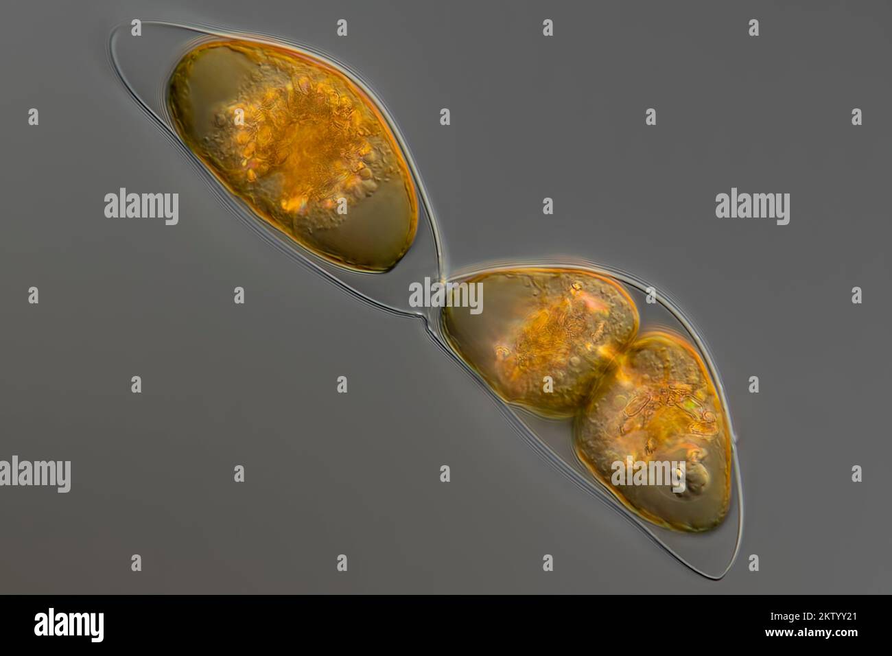 Pyrocystis sp. cf. algae, light micrograph Stock Photo - Alamy