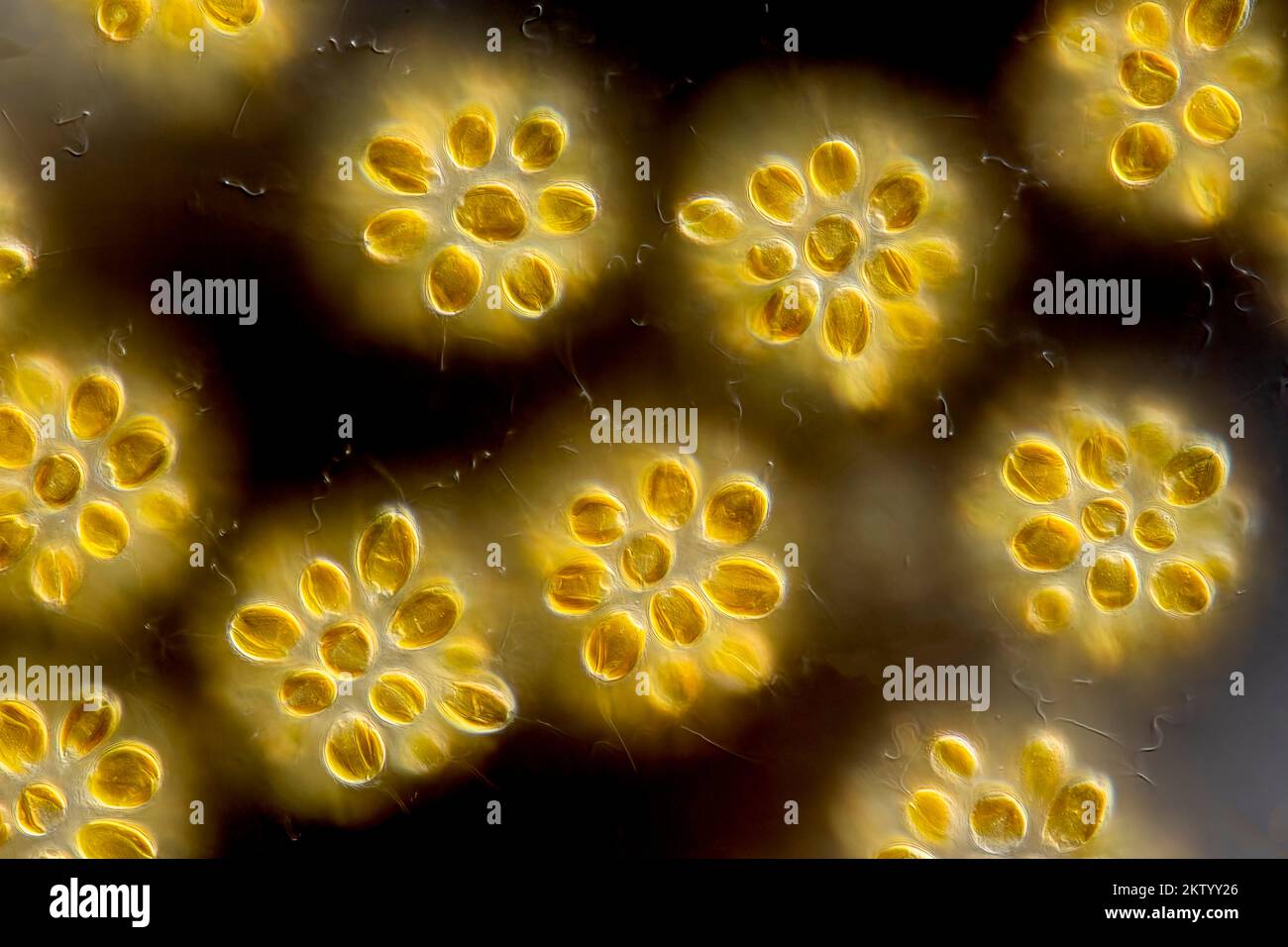 Synura sp. algae, light micrograph Stock Photo - Alamy