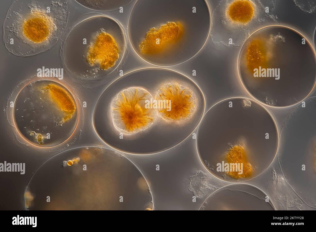 Pyrocystis noctiluca algae, light micrograph Stock Photo - Alamy