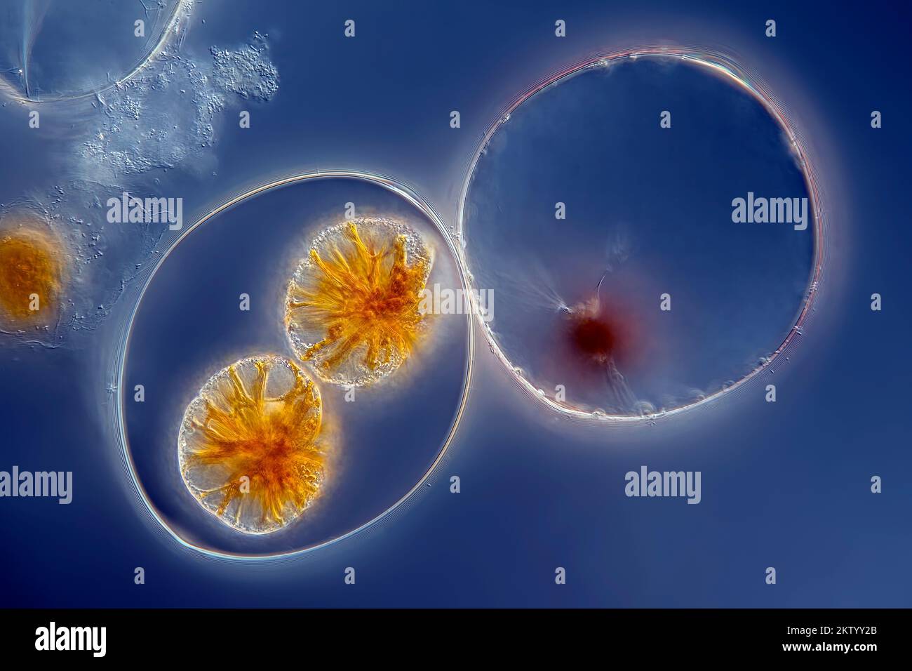 Pyrocystis noctiluca algae, light micrograph Stock Photo - Alamy