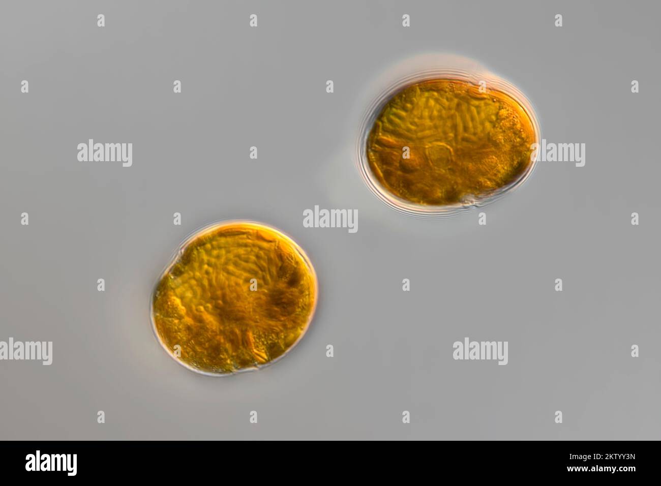 Peridinium centenniale algae, light micrograph Stock Photo - Alamy