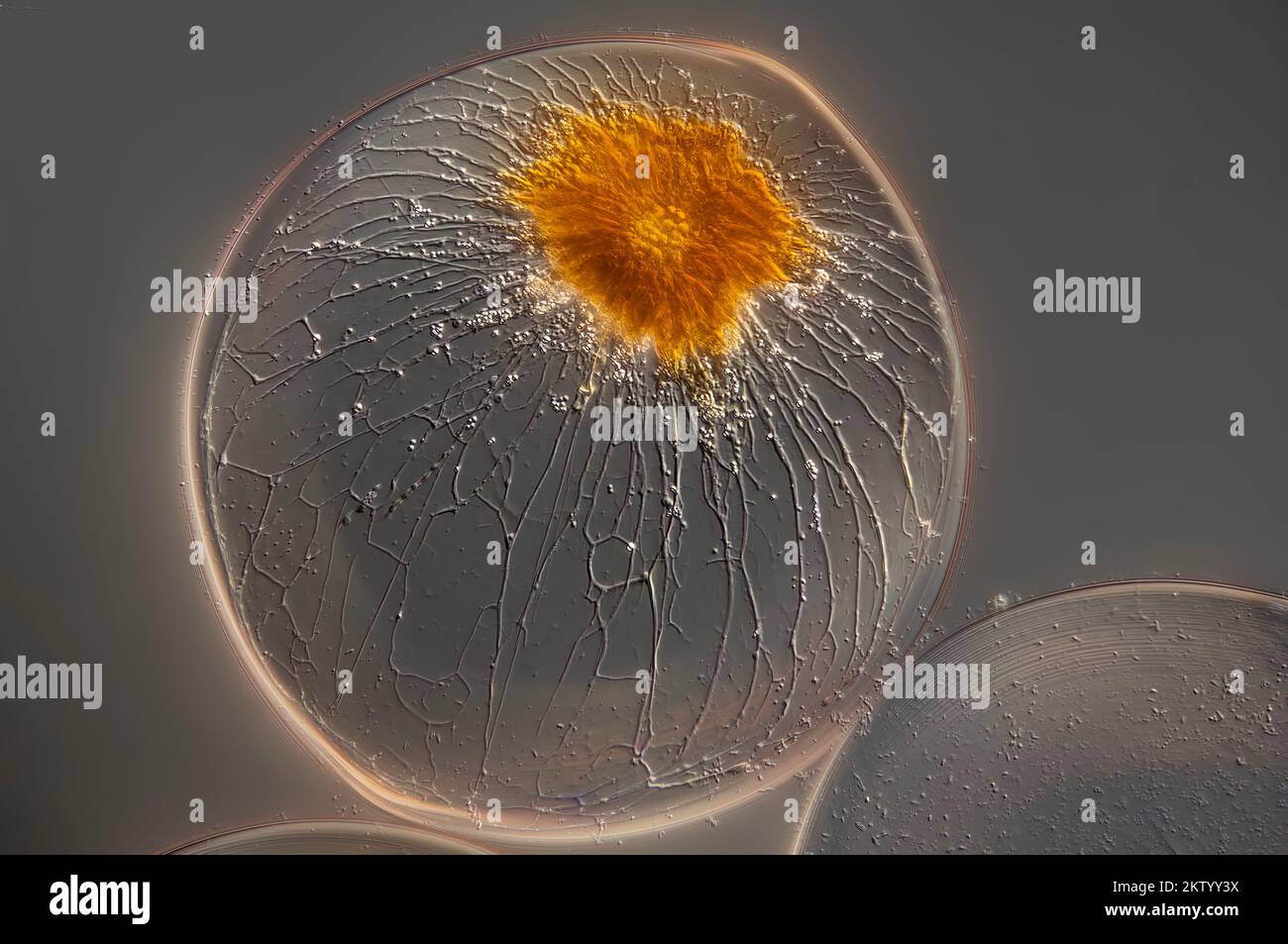 Pyrocystis noctiluca algae, light micrograph Stock Photo - Alamy