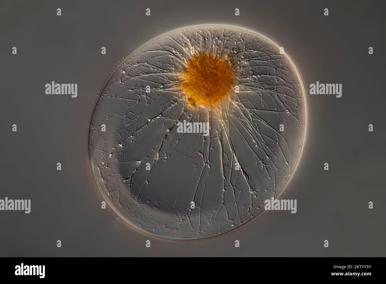 Pyrocystis noctiluca algae, light micrograph Stock Photo - Alamy