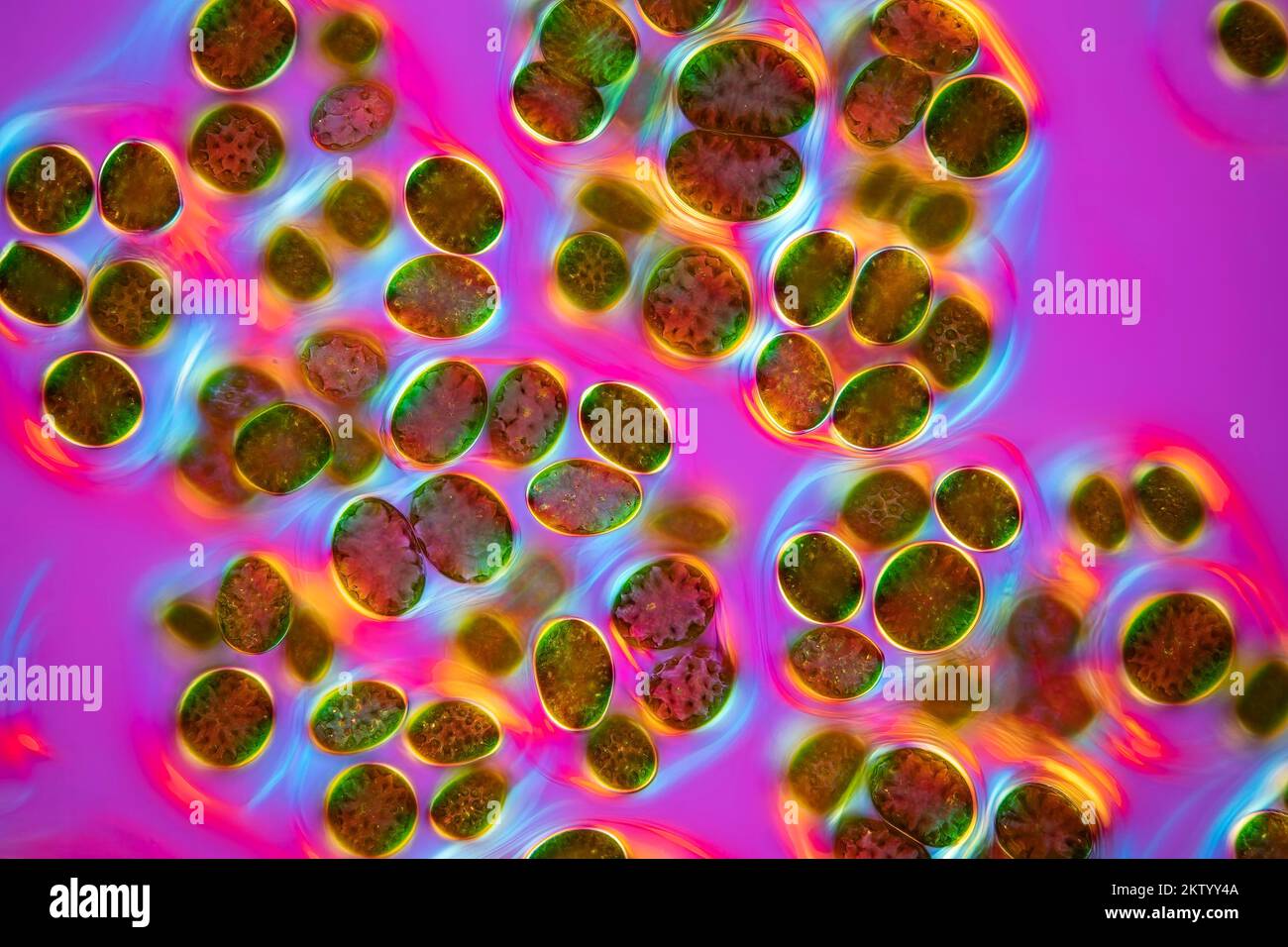 Neglectella eremosphaerophila algae, light micrograph Stock Photo - Alamy