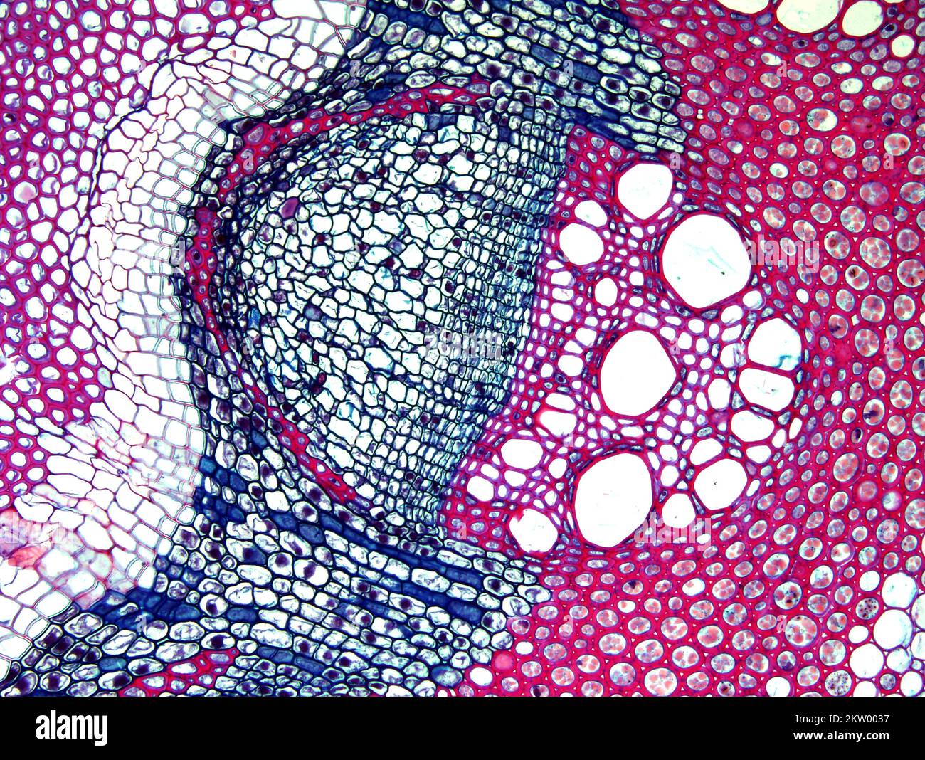 Clematis sp. vascular bundle, light micrograph Stock Photo - Alamy