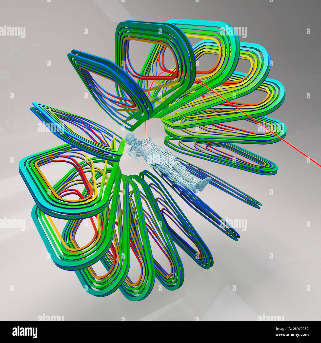 GaToroid gantry for cancer therapy, illustration Stock Photo - Alamy