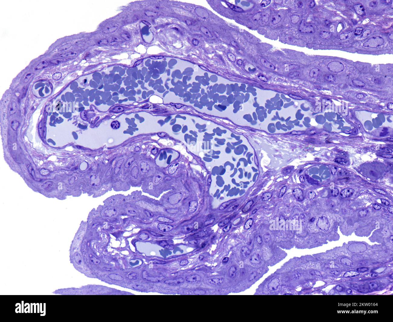 Venule, light micrograph Stock Photo - Alamy