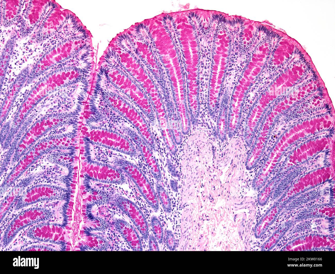 Large bowel, light micrograph Stock Photo - Alamy