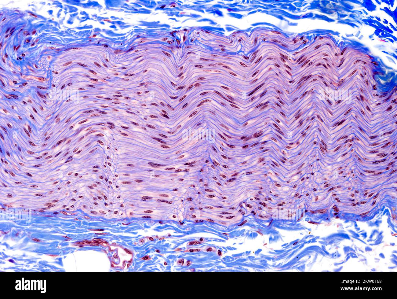 Peripheral nerve, light micrograph Stock Photo - Alamy