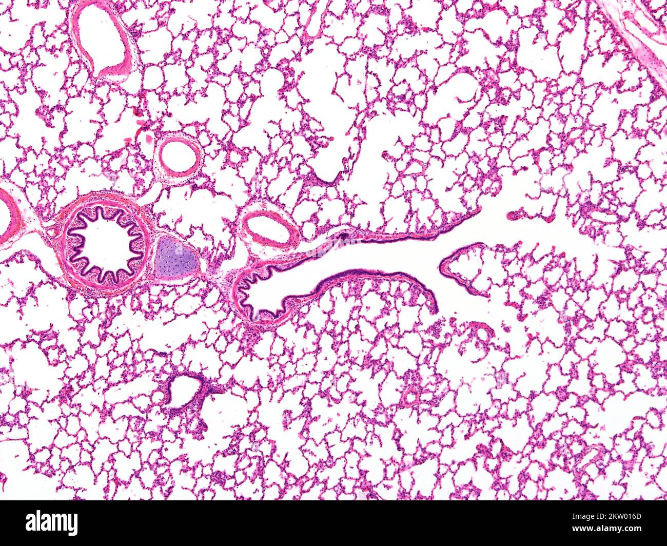Lung, light micrograph Stock Photo - Alamy