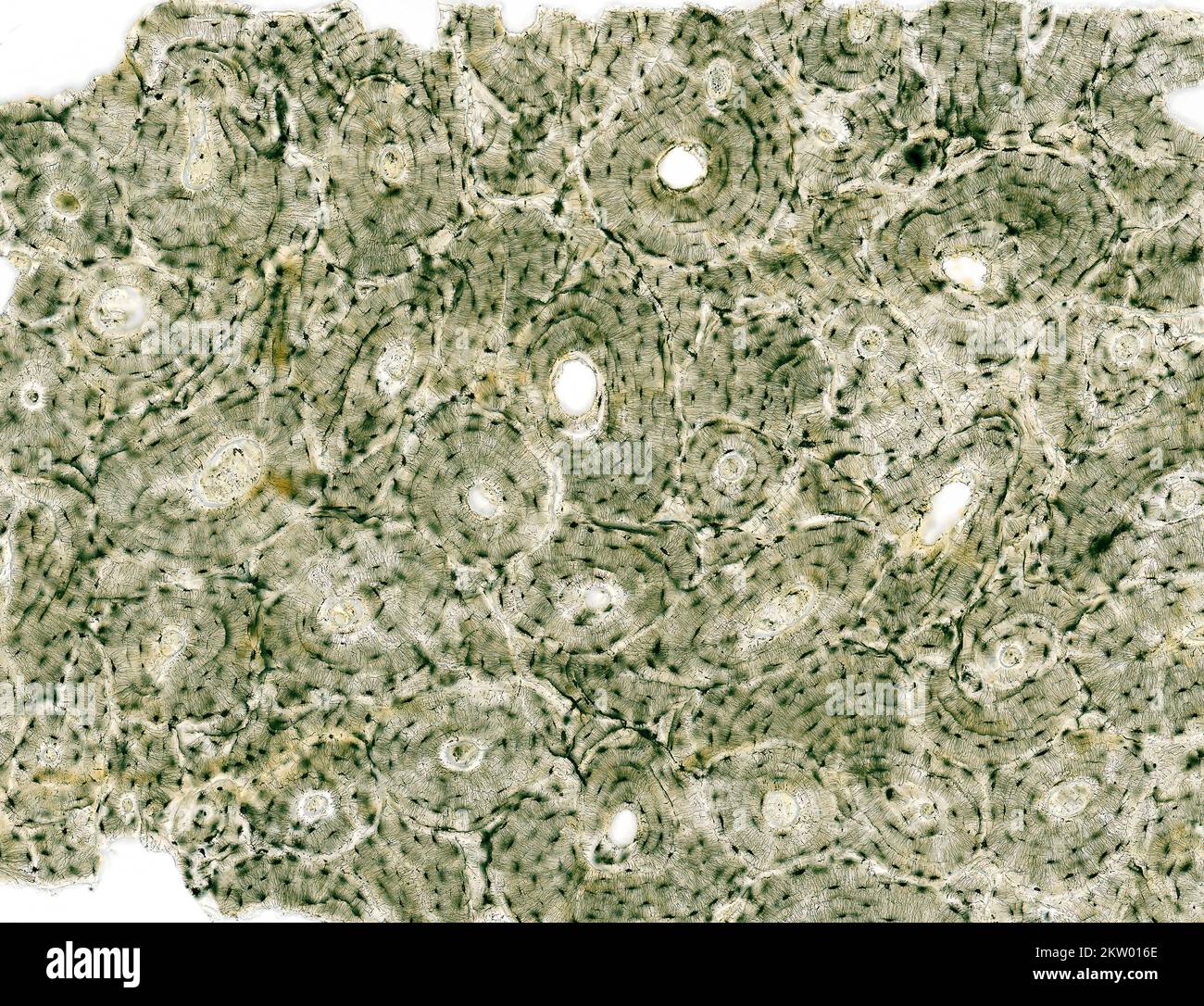 Bone tissue, light micrograph Stock Photo - Alamy