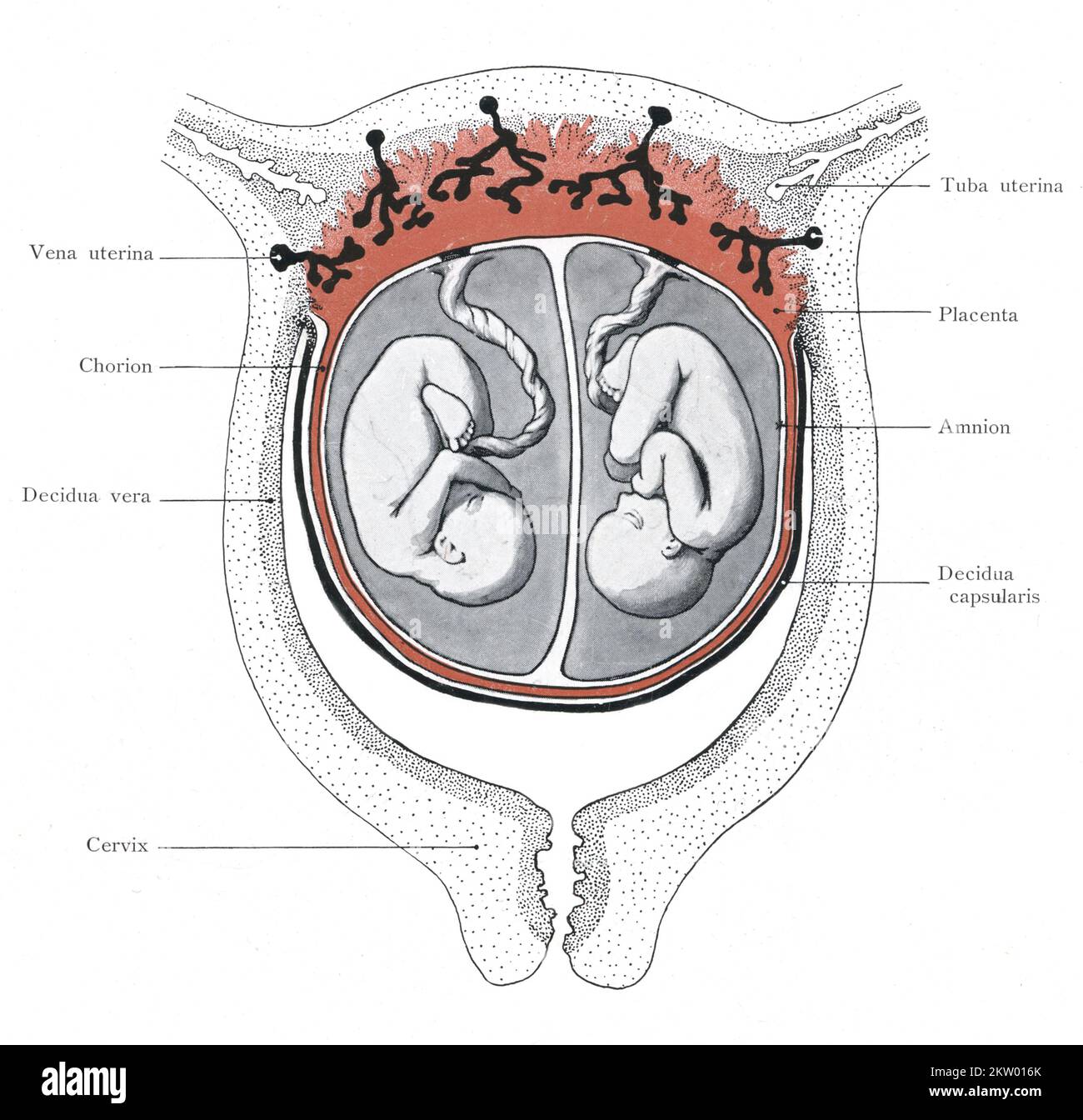 Twin foetuses, illustration Stock Photo - Alamy