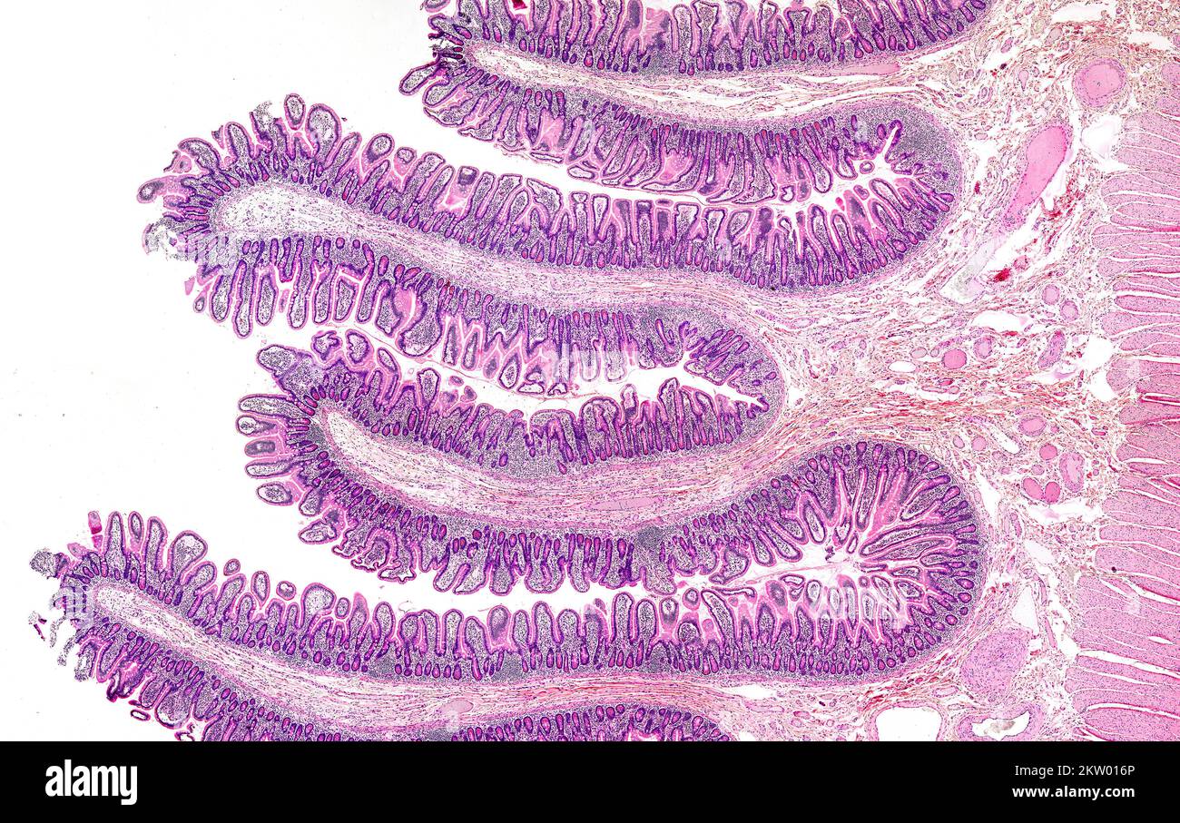 Small intestine, light micrograph Stock Photo - Alamy