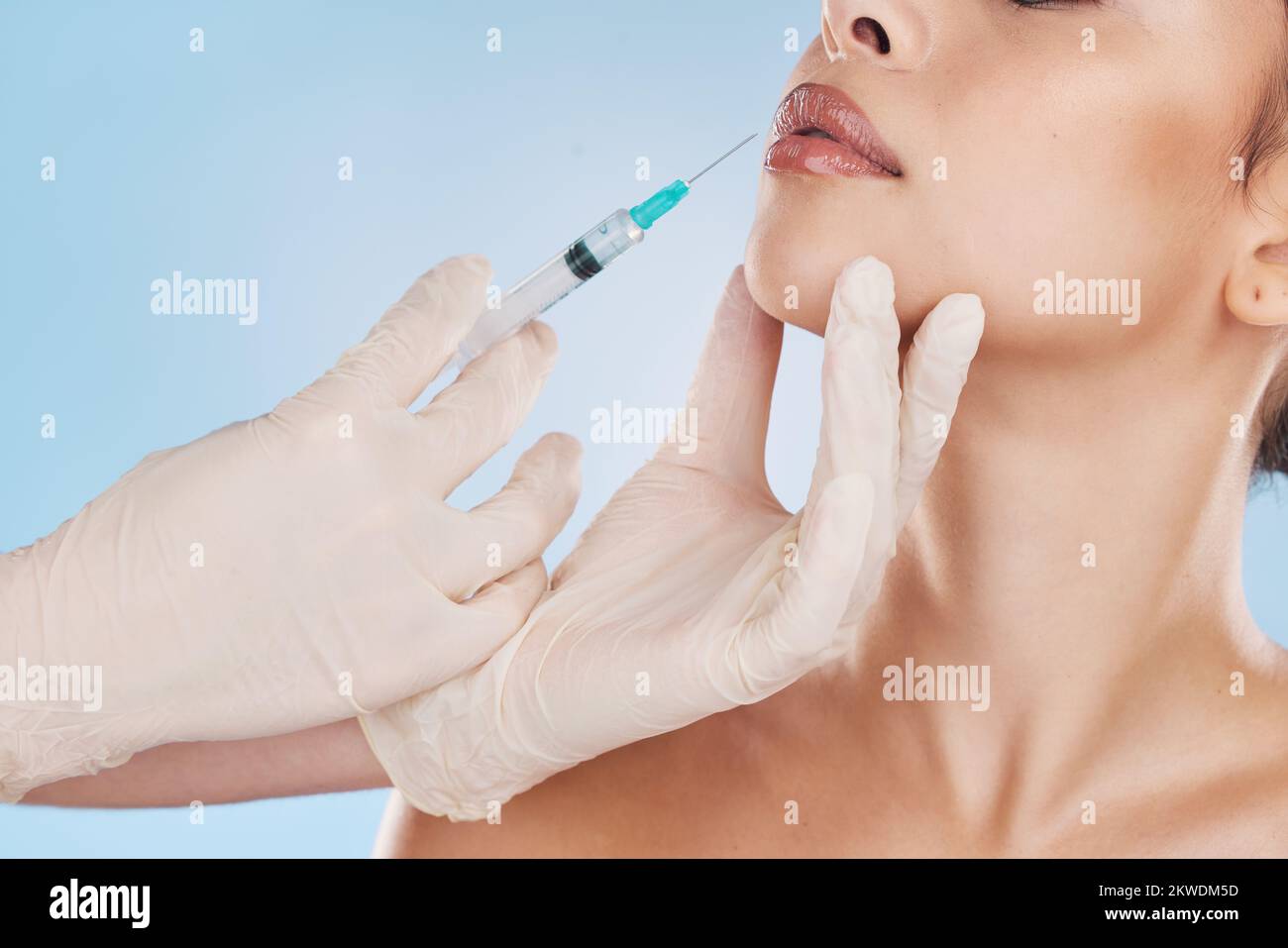 Botox, plastic surgery and filler with the lips of woman getting an ...