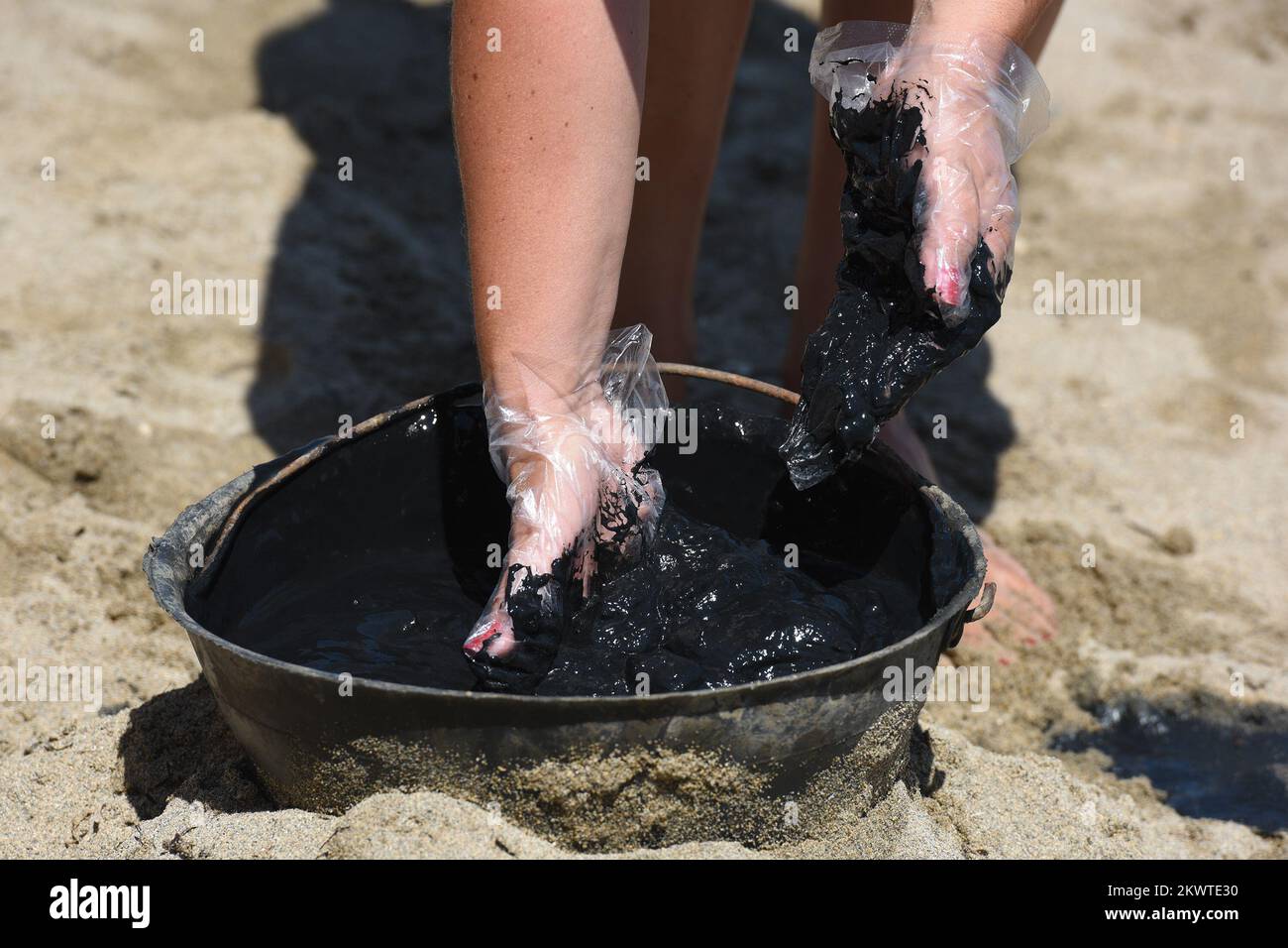 General view of people mud bathing on the beach at Nin, Croatia, 12.07. ...