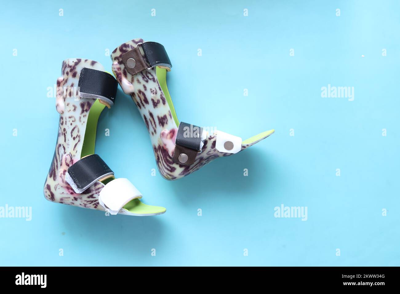 Child cerebral palsy disability, legs orthosis Stock Photo - Alamy