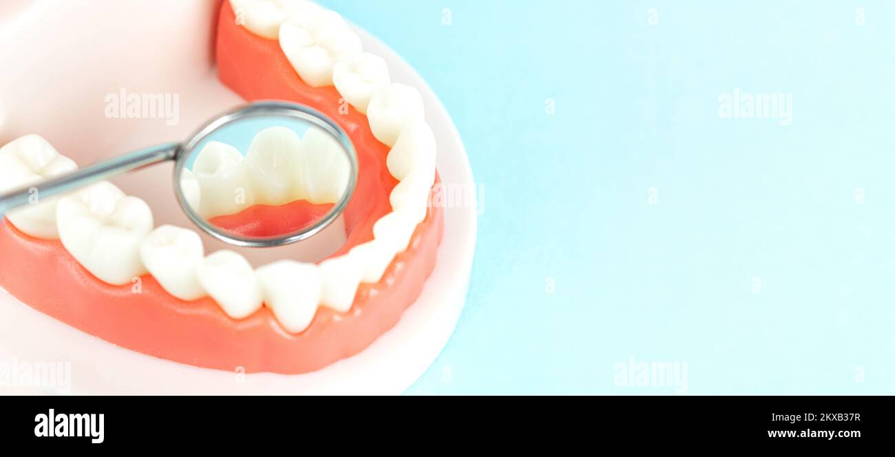 Prosthetic dentistry. Advertising. Removable denture. Dentist ...